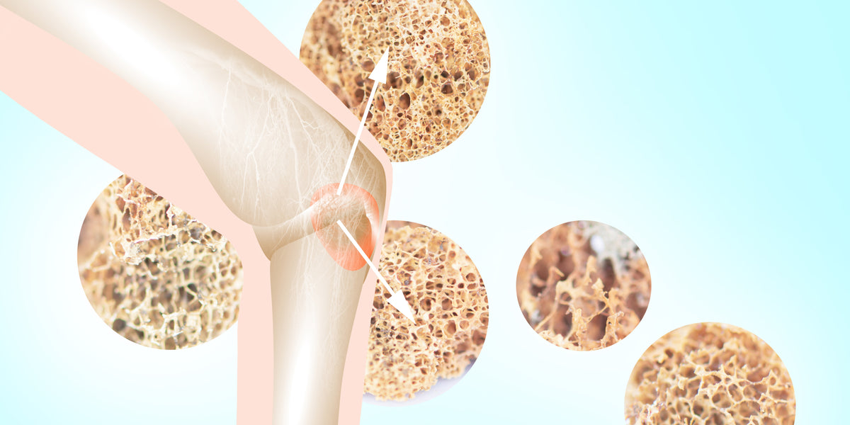 Prebiotics and Bone Density: Enhancing Calcium Absorption Naturally ...